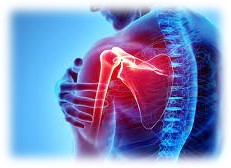 Shoulder Pain - Health First Group
